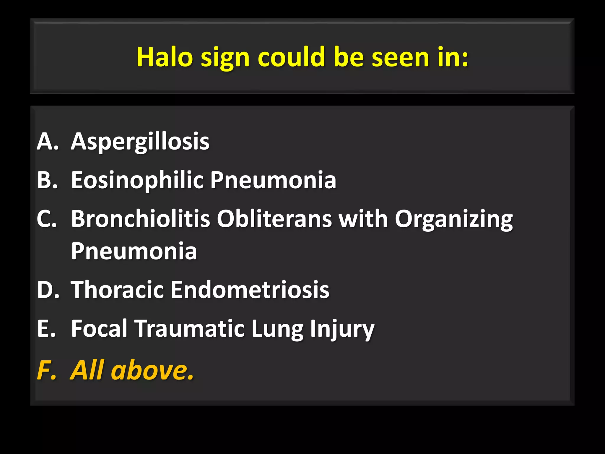Ct halo sign (part 1) | PPTX