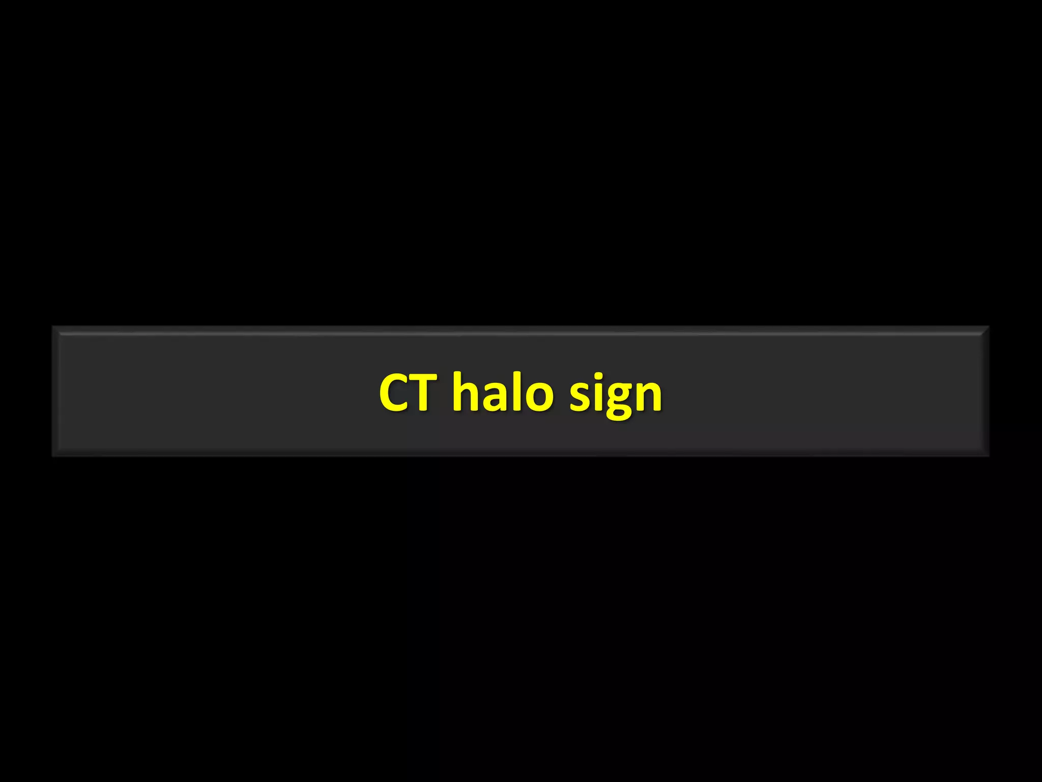 Ct halo sign (part 1) | PPTX