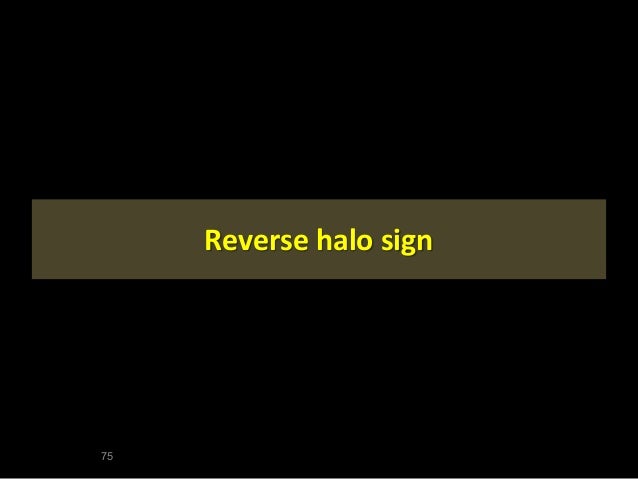 Ct halo sign (part 1)