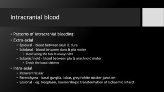 Approach to CT Head Imaging | PPTX