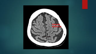 CT HEAD ANATOMY.pptx (NORMAL ANATOMY OF CT HEAD | PPTX