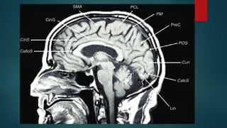 CT HEAD ANATOMY.pptx (NORMAL ANATOMY OF CT HEAD | PPTX