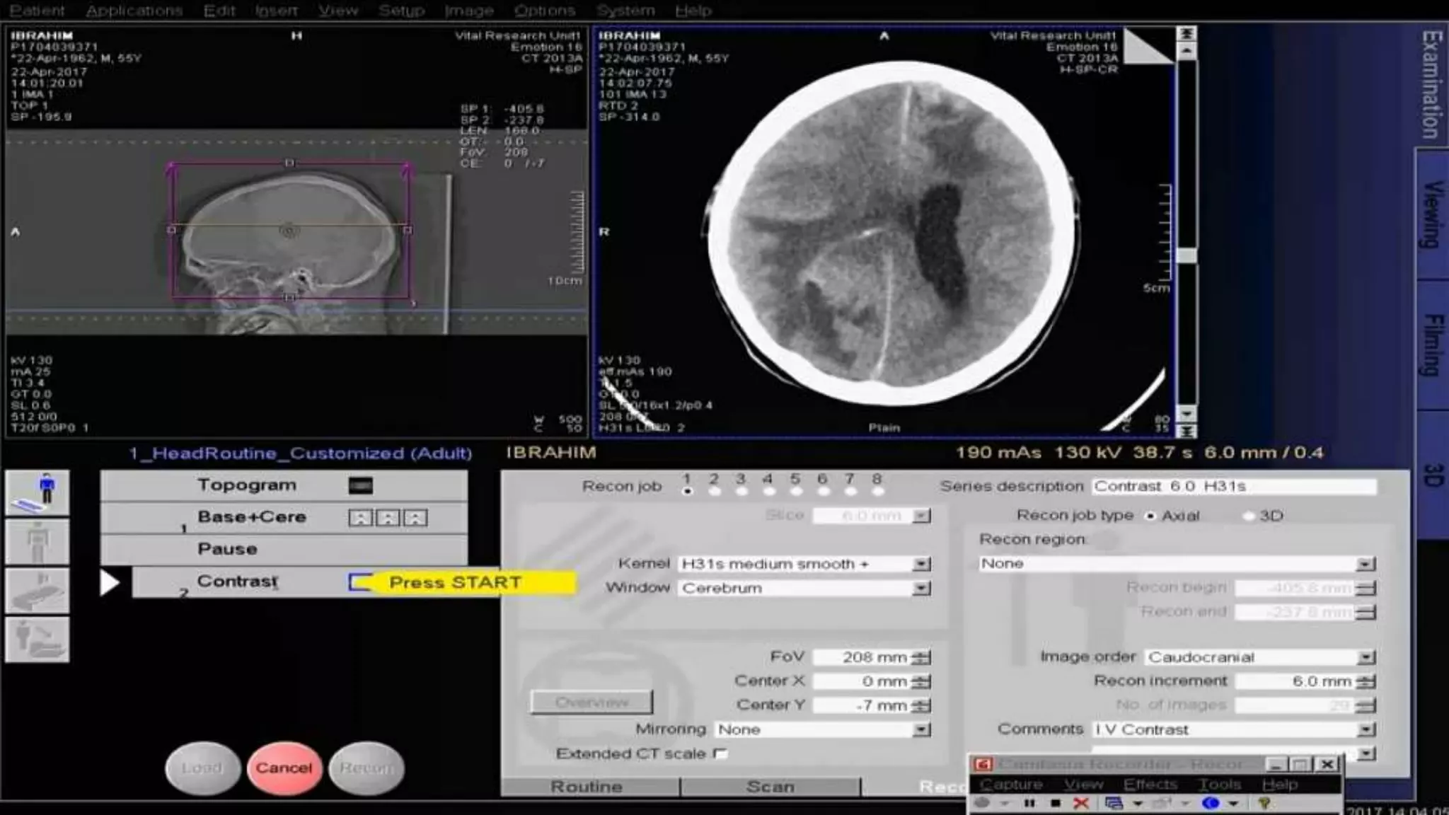Brain ct scan (anatomy and physiology) | PPTX
