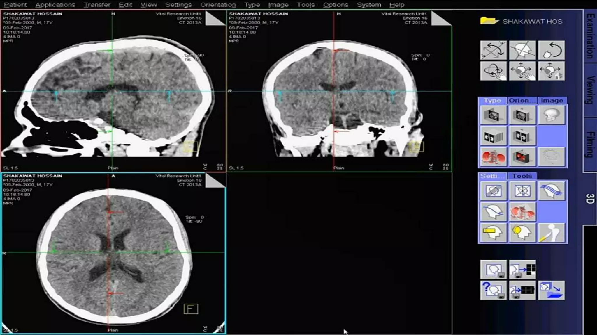 Brain ct scan (anatomy and physiology) | PPTX