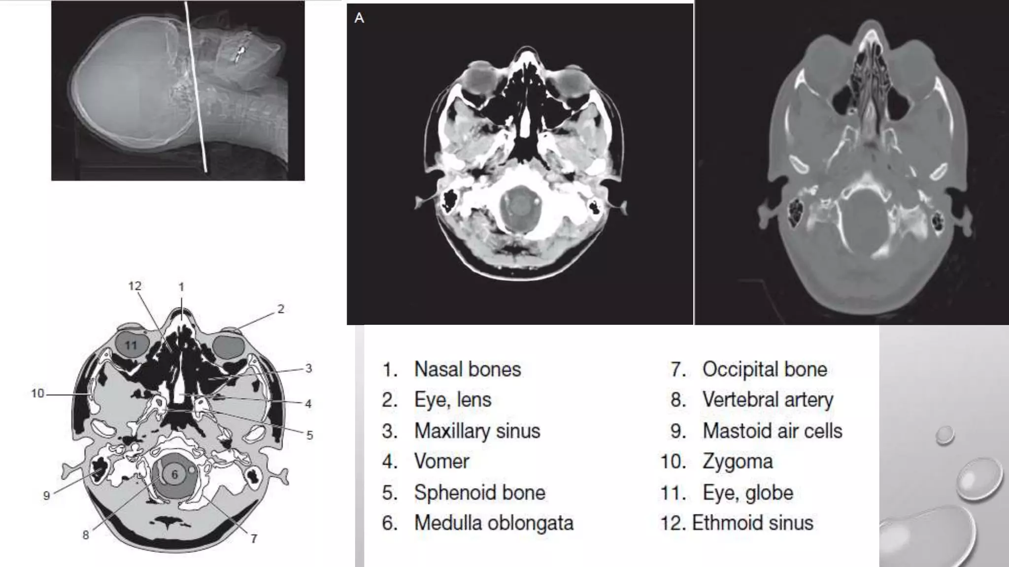 Brain ct scan (anatomy and physiology) | PPTX