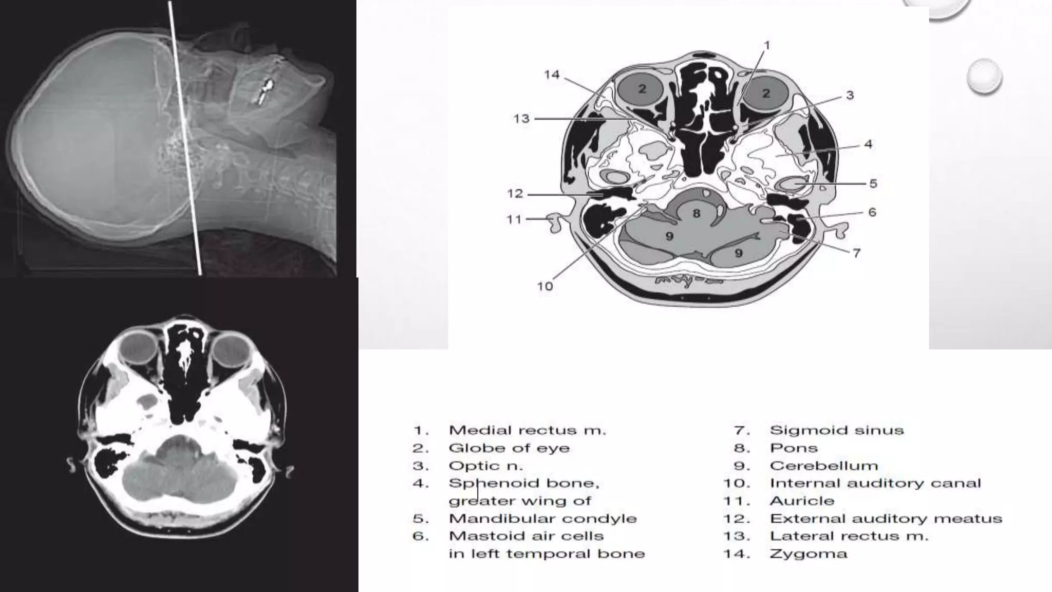 Brain ct scan (anatomy and physiology) | PPTX