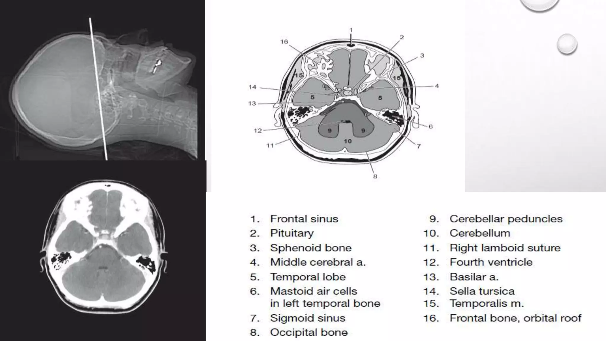 Brain ct scan (anatomy and physiology) | PPTX