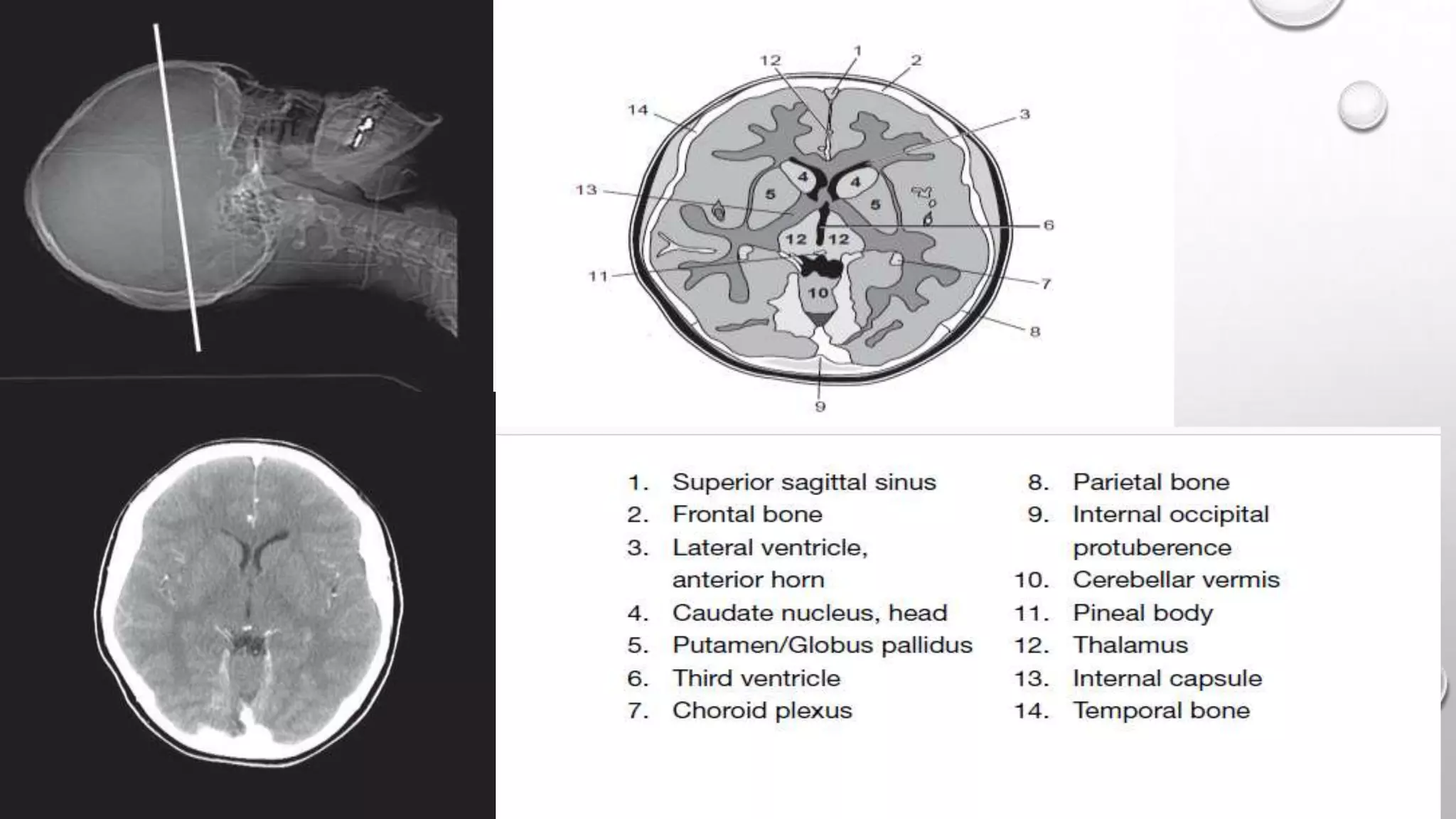 Brain ct scan (anatomy and physiology) | PPTX