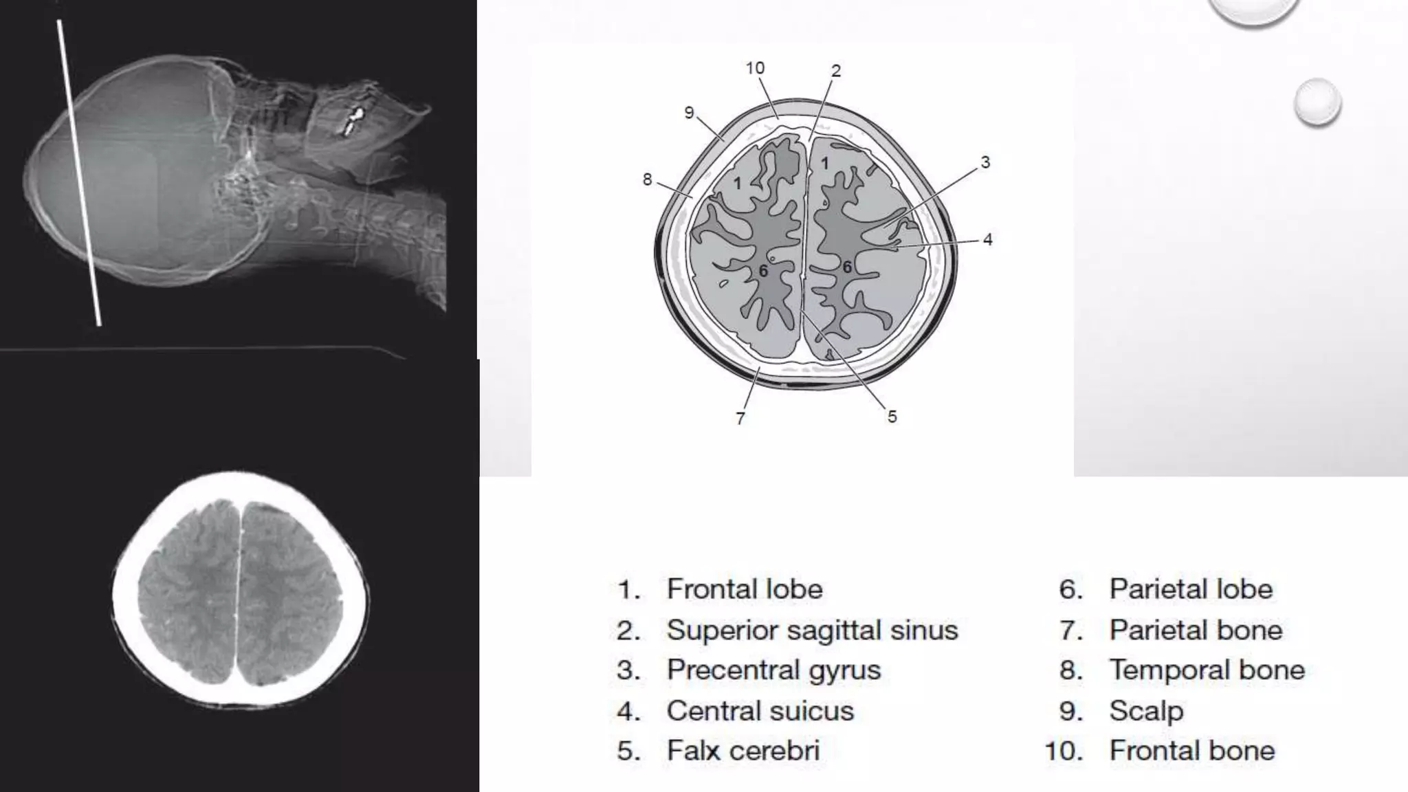 Brain ct scan (anatomy and physiology) | PPTX