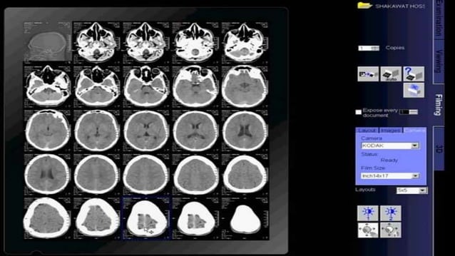 Brain ct scan (anatomy and physiology) | PPT