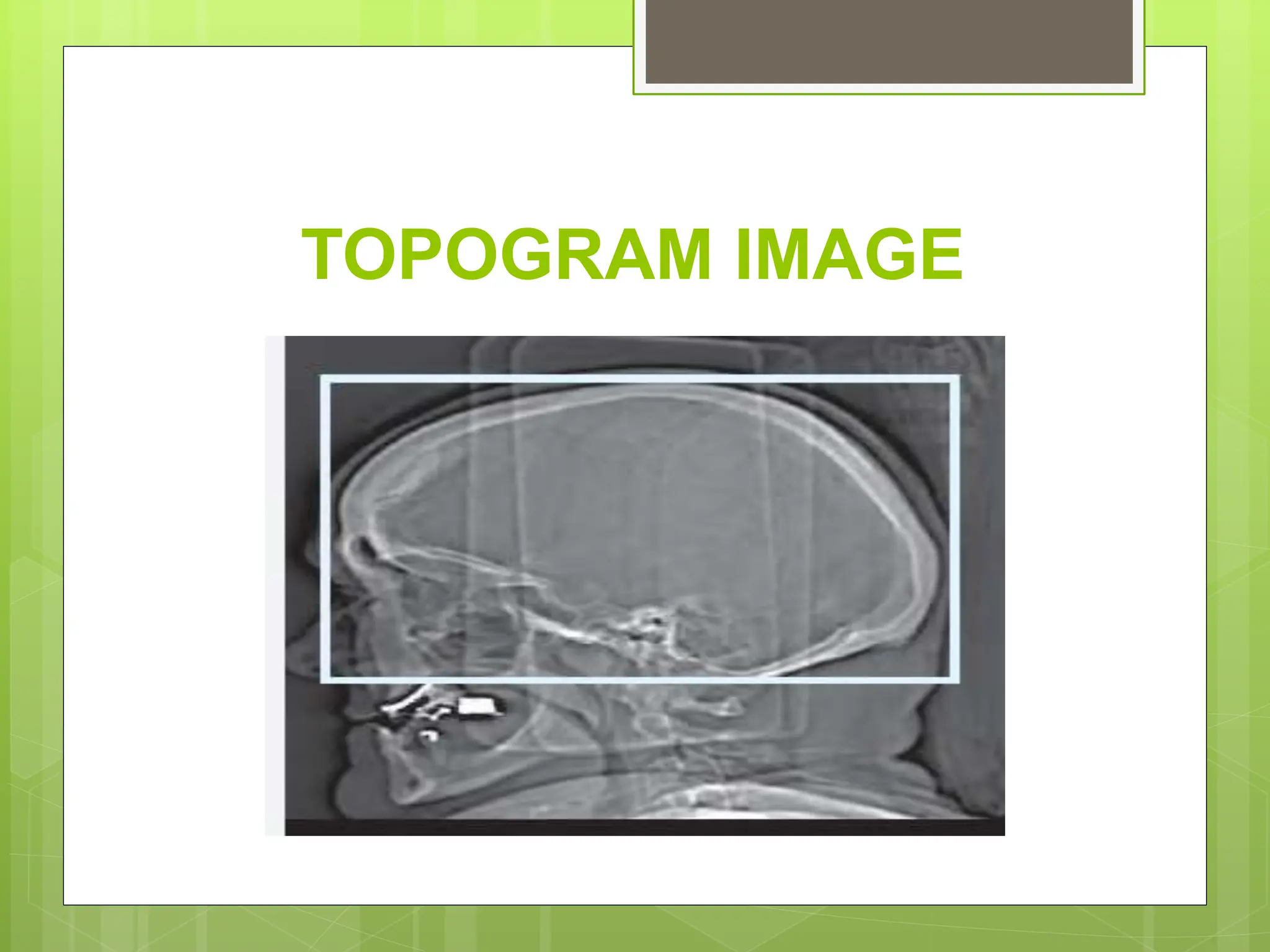 CT Head (Cerebral) Angiography.pptx, internal carotid artery. 2 ...