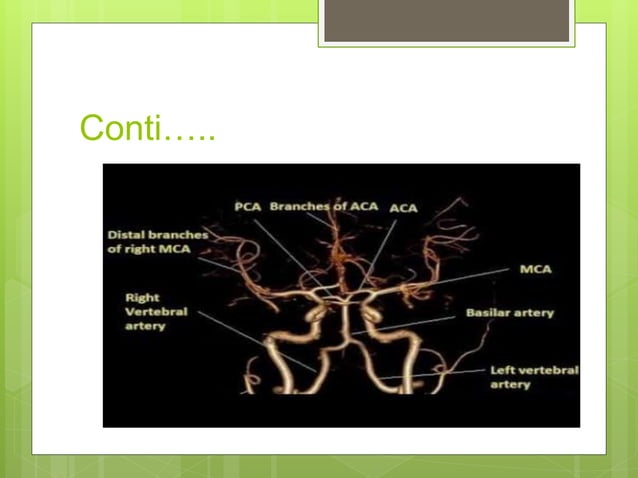 CT Head (Cerebral) Angiography.pptx, internal carotid artery. 2 ...