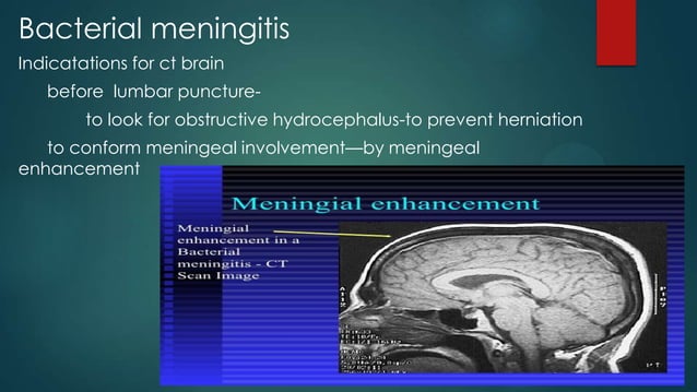 Ct brain presentation | PPTX