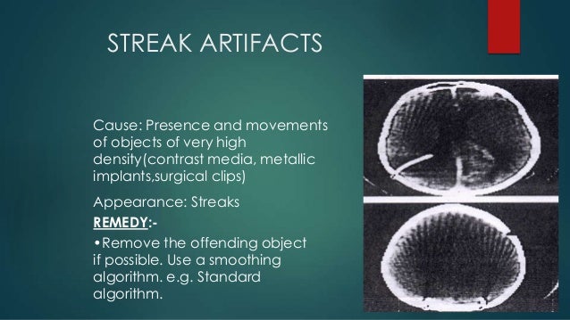 Ct brain presentation