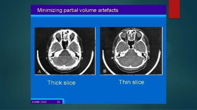 Ct brain presentation