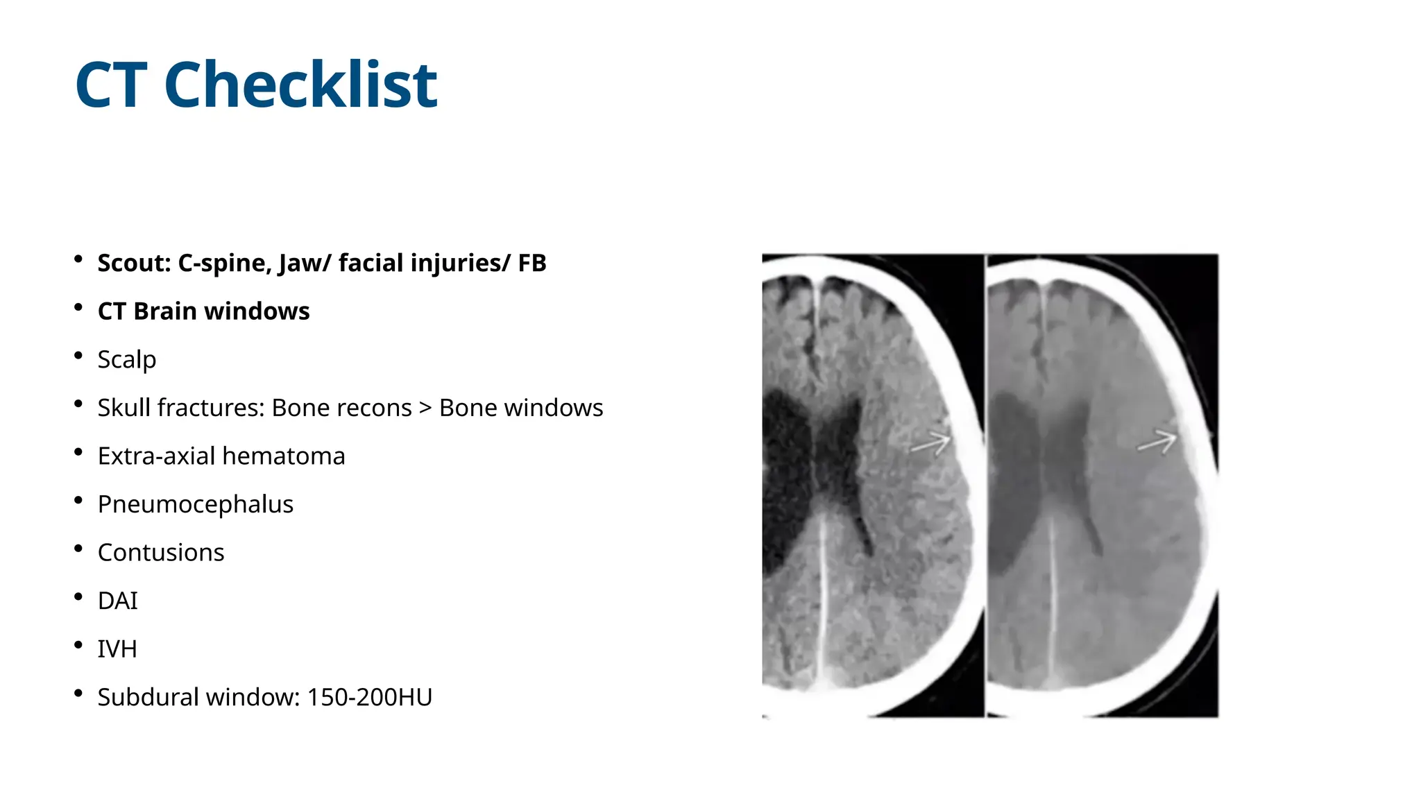 CT imaging in Head trauma checklist features | PPTX