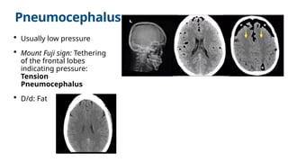 CT imaging in Head trauma checklist features | PPTX