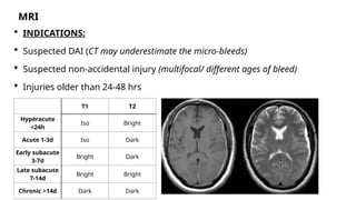 CT imaging in Head trauma checklist features | PPTX