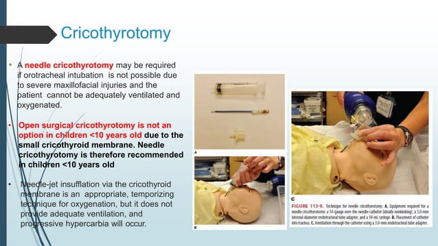 CTH PAEDIATRIC TRAUMA.pptx