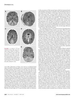 Ct hypodensity accidpedinj_neurosurg_steinbok_poskitt | PDF