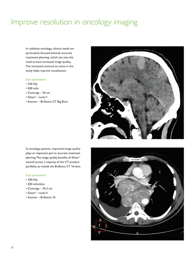Ct idose brochure | PDF