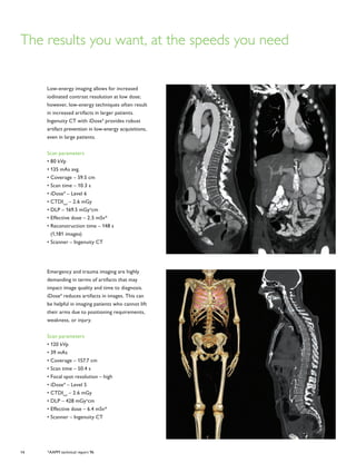 Ct idose brochure | PDF