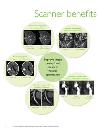 Ct idose brochure | PDF