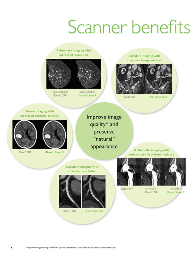 Ct idose brochure | PDF