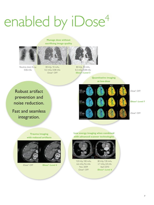 Ct idose brochure | PDF