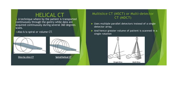 CT image acquisition | PPTX