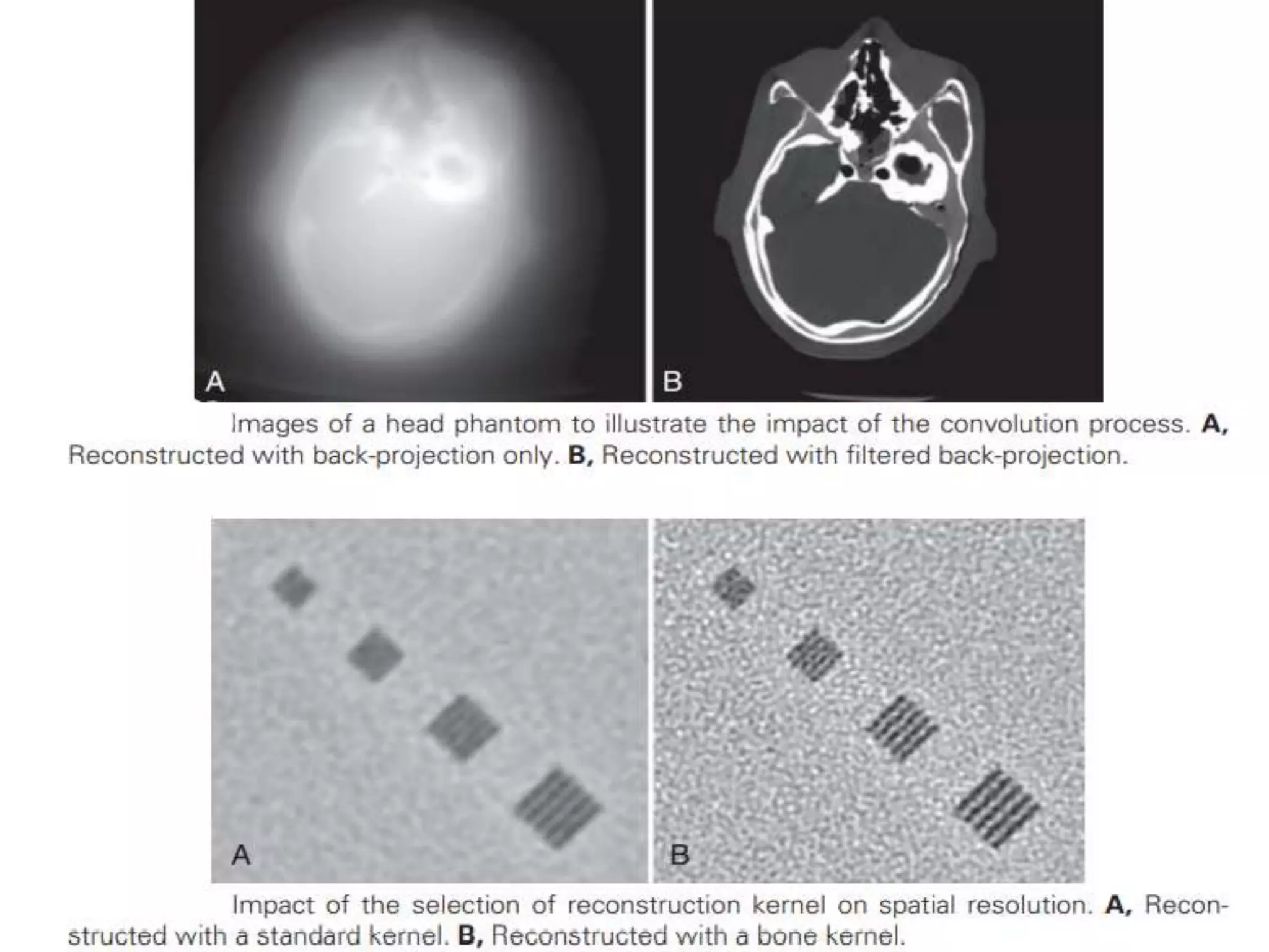 CT image quality and image resolution.pptx