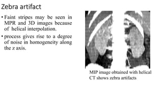 Ct image quality artifacts and it remedy | PPT