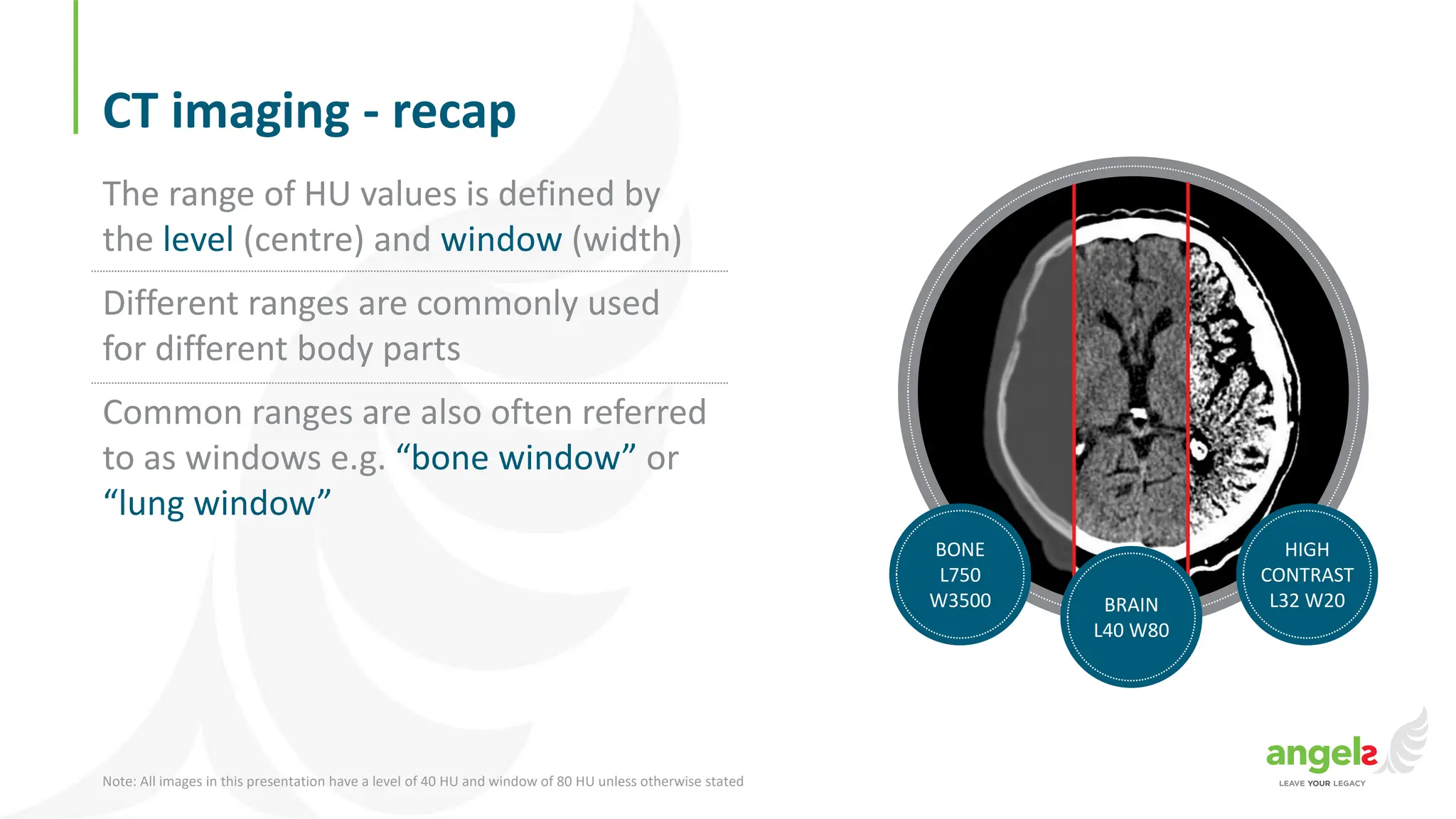 ct_imaging_2019_lyl_v01_2 ct_imaging_2019_lyl_v01_2 (1).pptxct_imaging ...