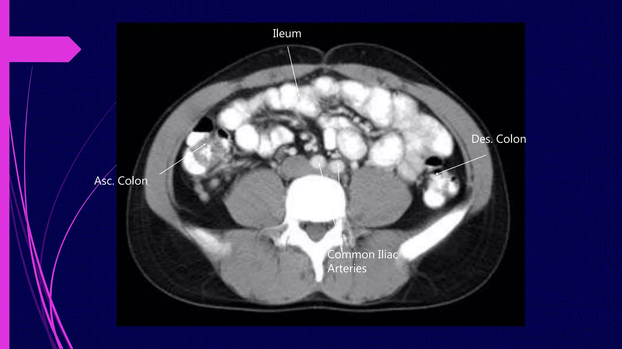 Ct Imaging of Abdomen Dr. Muhammad Bin Zulfiqar | PPTX