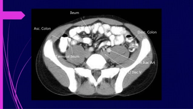 Ct Imaging of Abdomen Dr. Muhammad Bin Zulfiqar