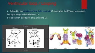 CT in congenital heart diseases | PPTX