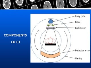 CT INSTRUMENTATIONSsnsjsjsjwjwjnwjajaj.pptx