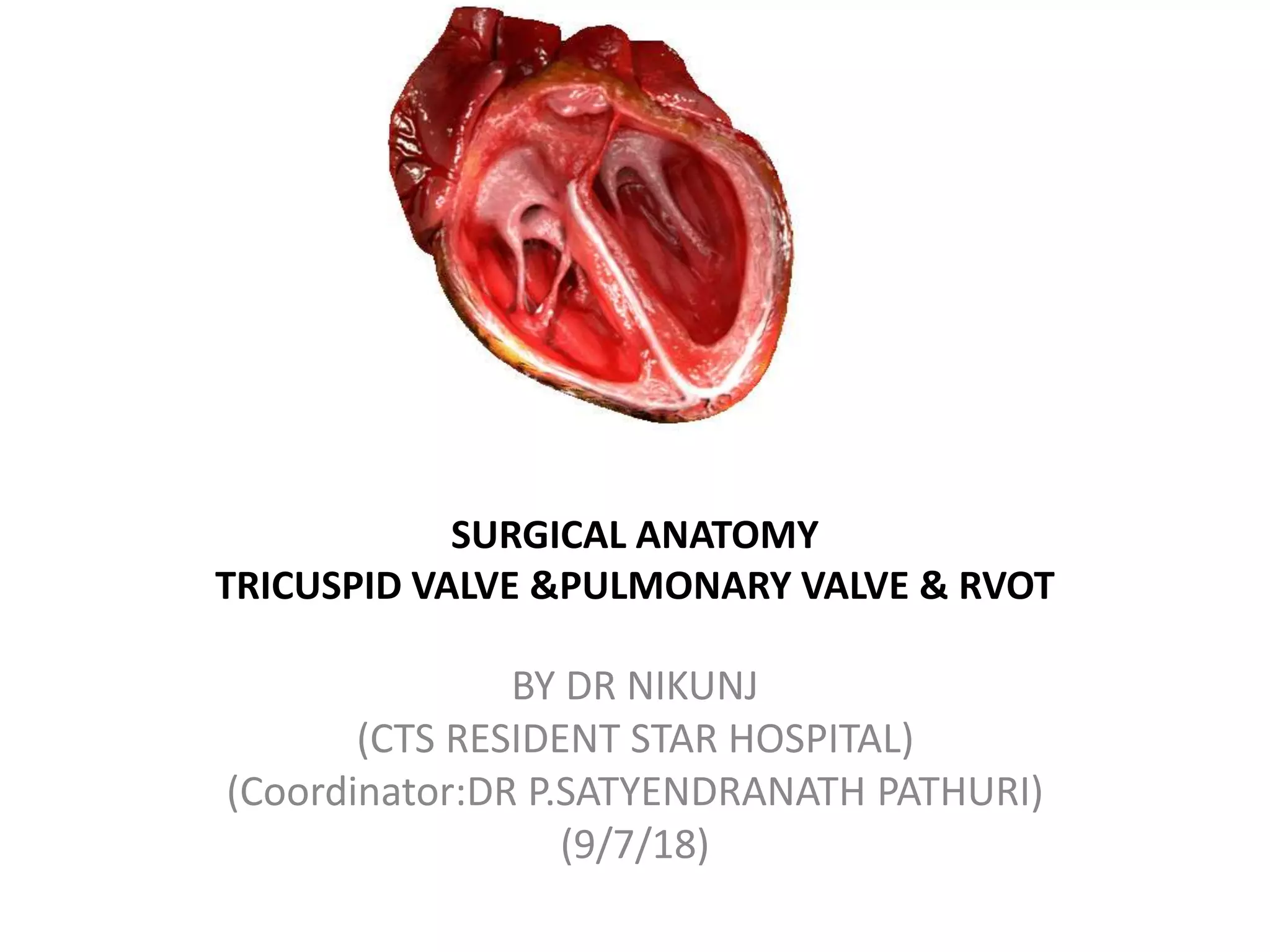 Anatomy tricuspid valve DR NIKUNJ R SHEKHADA (MBBS,MS GEN SURG ,DNB CTS ...