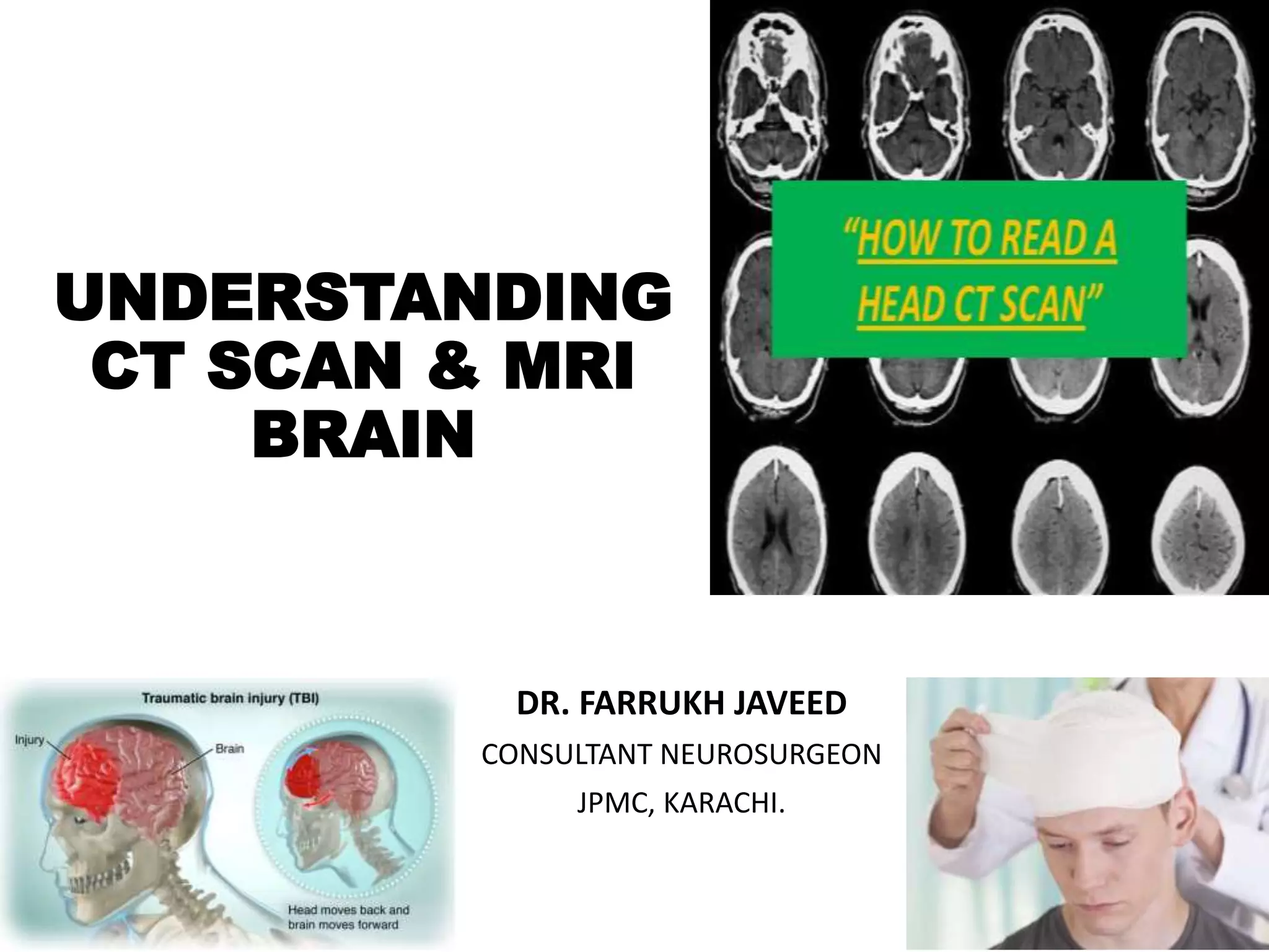 Understanding CT Scan and MRI Brain for Undergraduate Medical Students ...