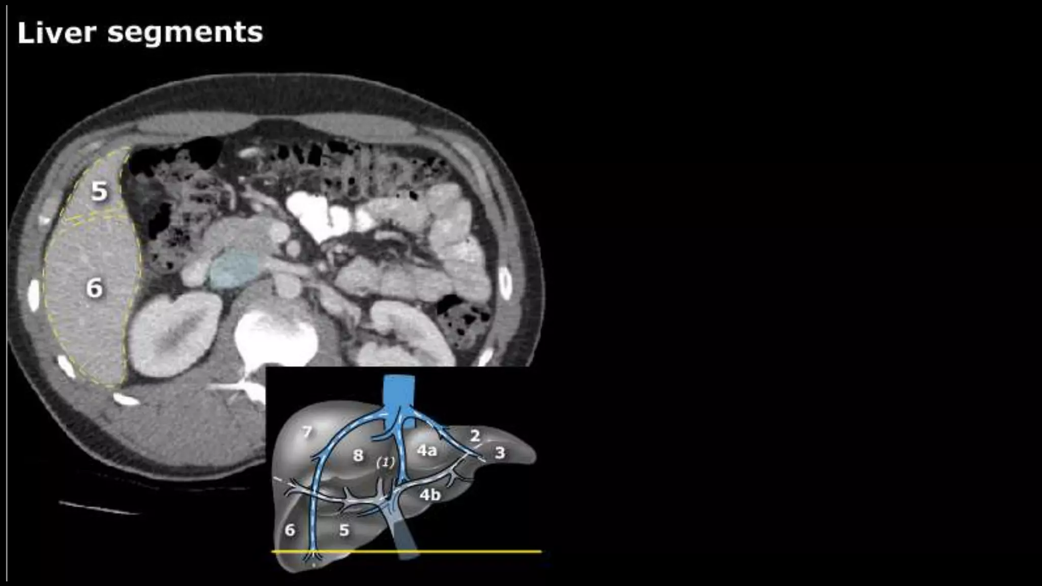 LIVER SEGMENT ANATOMY CT SCAN | PPTX | Digestive Disorders | Diseases ...