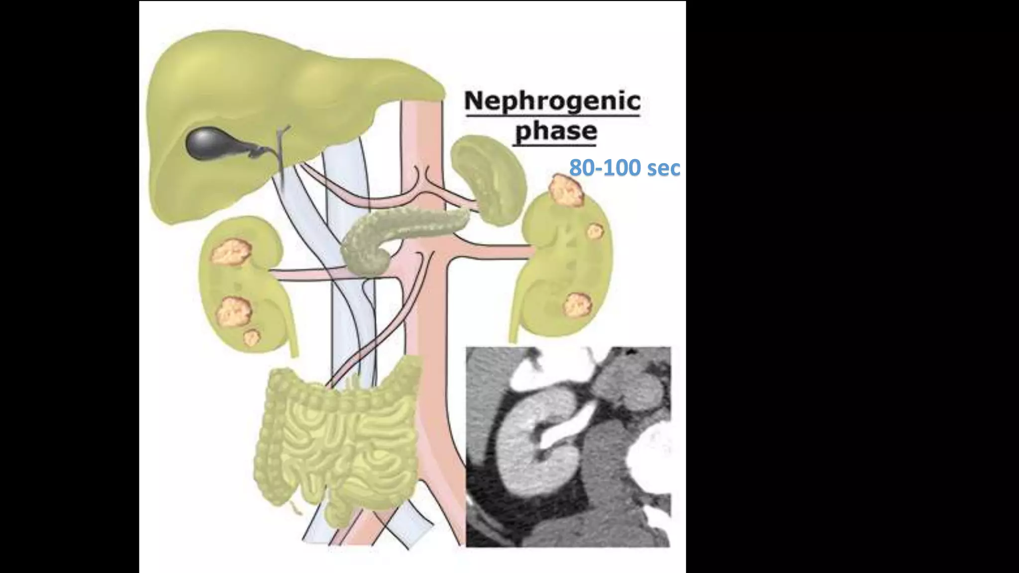 LIVER SEGMENT ANATOMY CT SCAN | PPTX | Digestive Disorders | Diseases ...
