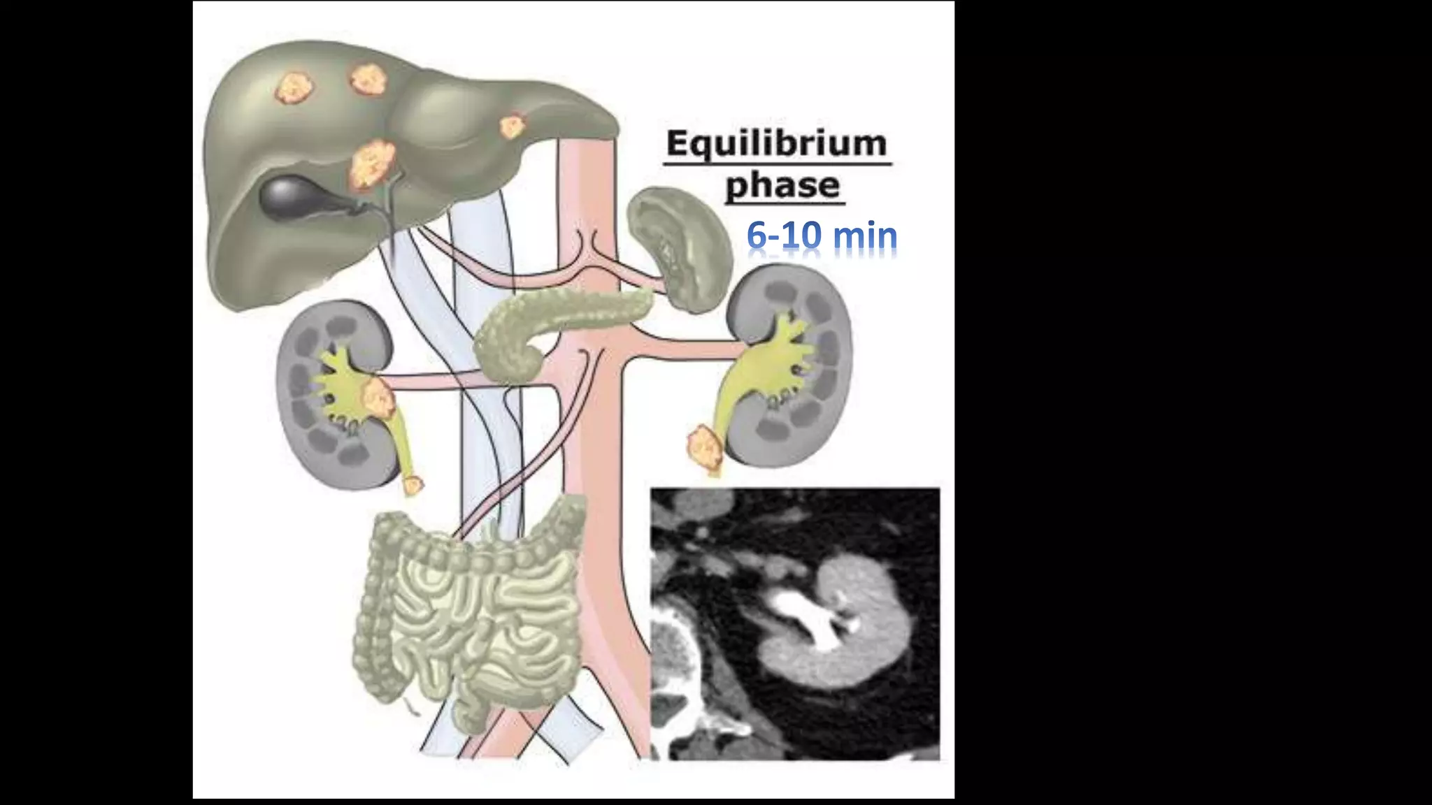 LIVER SEGMENT ANATOMY CT SCAN | PPTX
