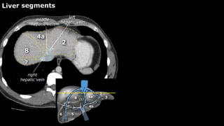 LIVER SEGMENT ANATOMY CT SCAN | PPTX