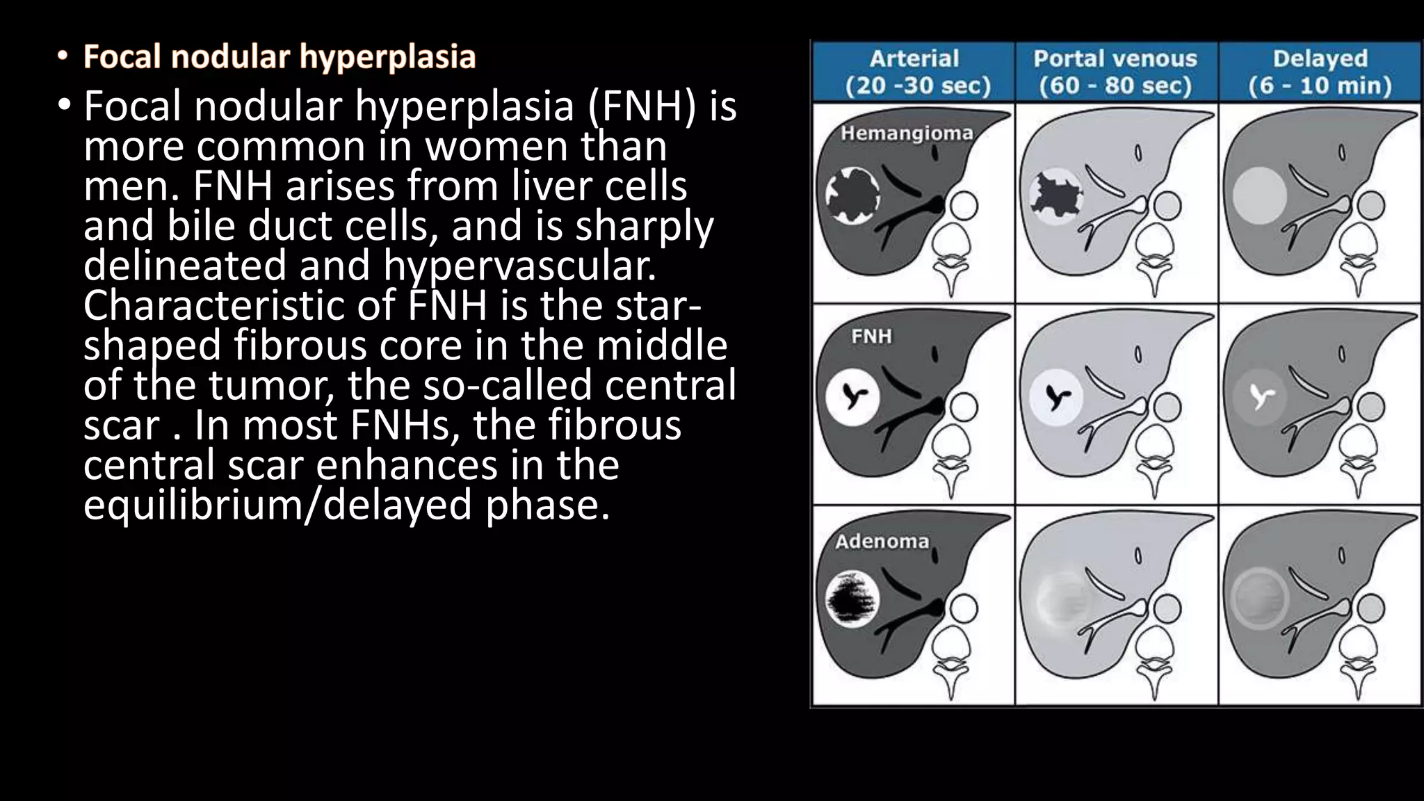 CT liver segments ANATOMY BIPHASI TRIPHASIC | PPTX