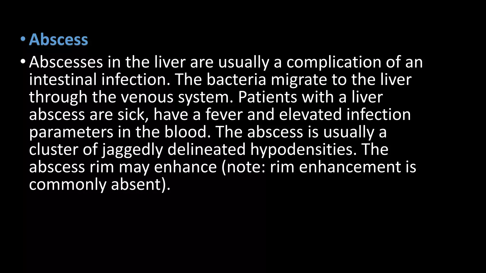 Liver segments Radiopaedia.com1