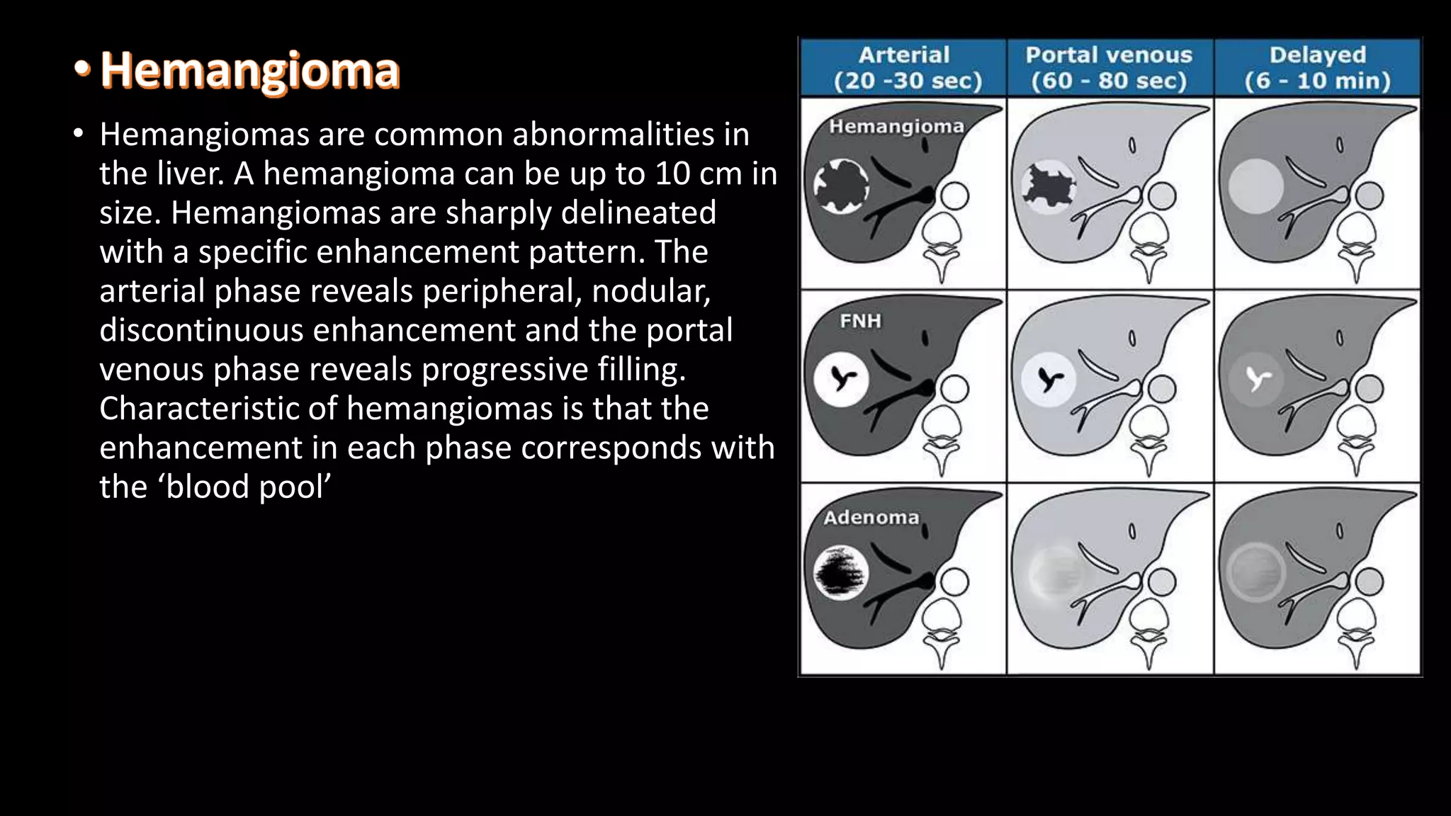 Liver segments Radiopaedia.com1