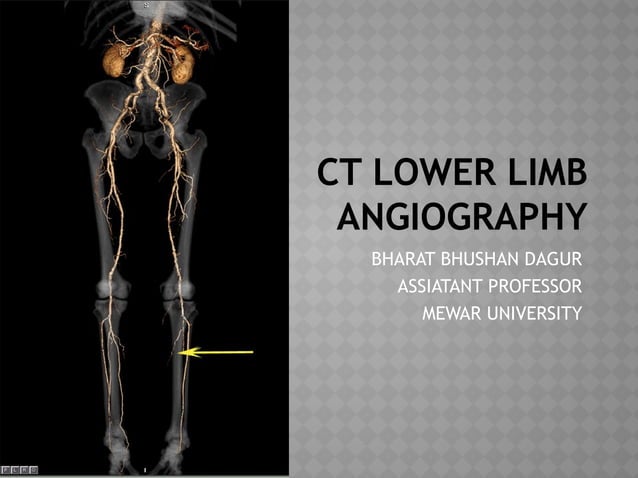 CT Lower Limb Angiography: Techniques, Indications, Protocols, Image ...