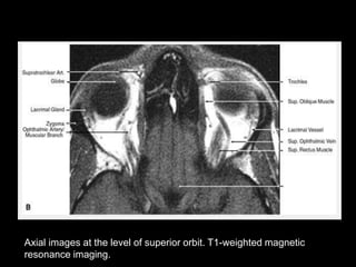 CT and MRI | PPTX