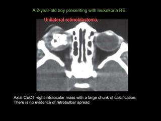 CT and MRI | PPTX