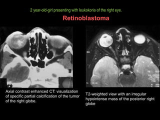 CT and MRI | PPTX